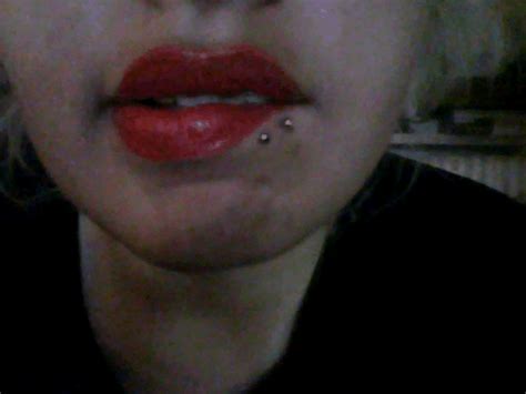 Braces Gifs WiffleGif