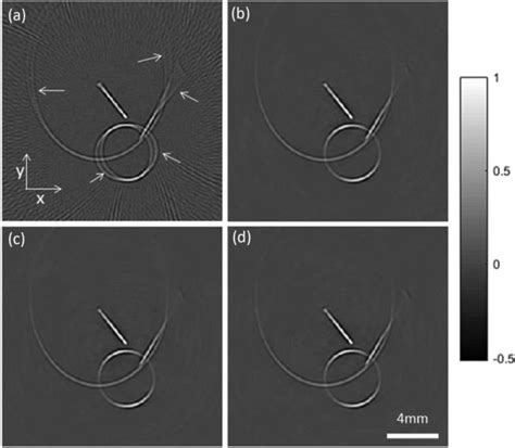 Reconstruction Results Using A The Conventional Backprojection Download Scientific Diagram