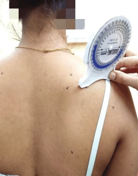 Scapular Upward Rotation Test Download Scientific Diagram