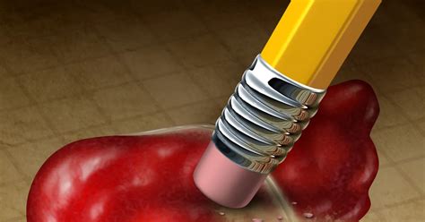 6 Medical Facts On Primary Biliary Cholangitis ActiveBeat Your Daily Dose Of Health Headlines