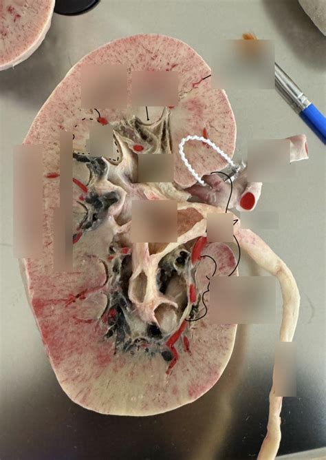 Lom Renal Lab Diagram 6 Diagram Quizlet