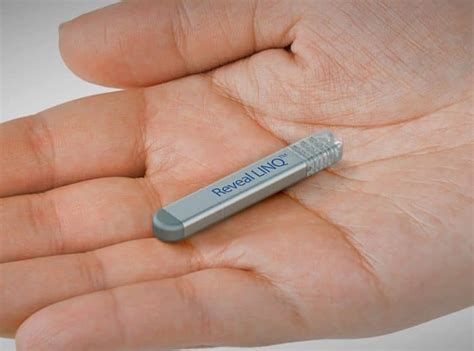 Loop Recorder Implantation Cos Cardio