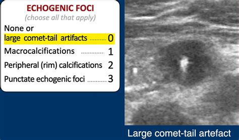 The Radiology Assistant Ti Rads Thyroid Imaging Reporting And Data