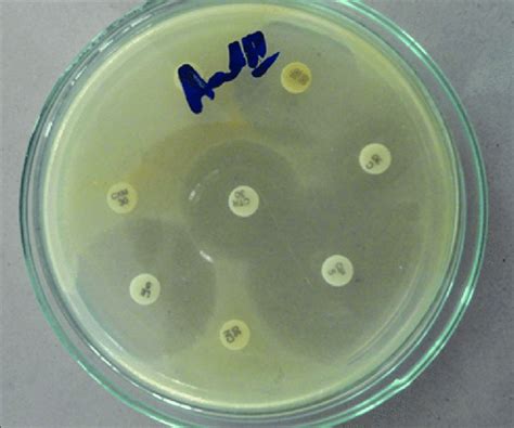 Antibiotic Sensitivity Test Of Isolates On Mueller Hinton Agar