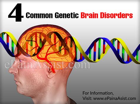 4 Common Genetic Brain Disorders And Its Treatment