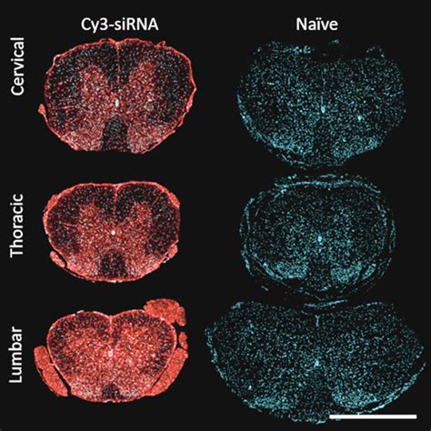 Intrathecal Injection Procedures A Setup And Materials Needed For Download Scientific
