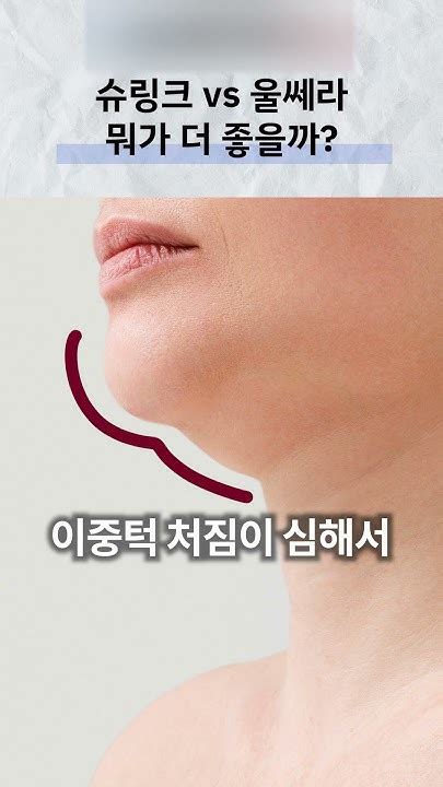 슈링크 Vs 울쎄라 나한텐 뭐가 더 좋을까 슈링크울쎄라피부과 Youtube