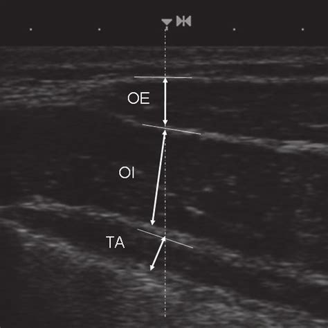 Hip Angular Velocity Net Moment Of Force And Moment Power ± 1 Sd Download Scientific