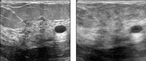 논문 리뷰 Pca For Enhanced Cross Dataset Generalizability In Breast