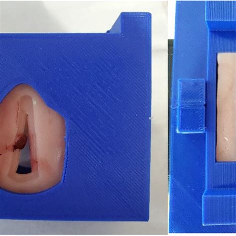 Synthetic Vocal Fold Model And Cassette Download Scientific Diagram