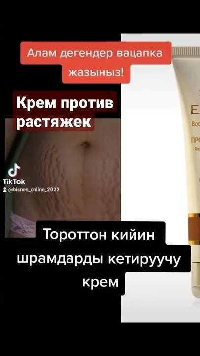 Крем против растяжек для женщин во время беременности для профилактики появления растяжек Youtube