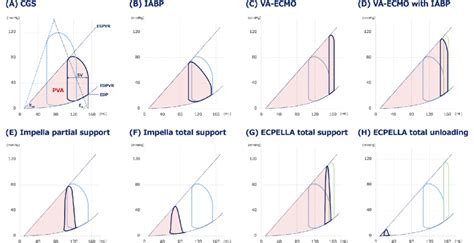 Pv Loops Under Various T Mcs Conditions For The Treatment Of