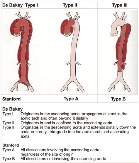 Figure 1 The Most Common Classification Systems Of Grepmed