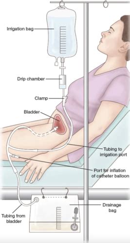 Module 13 Elimination Flashcards Quizlet