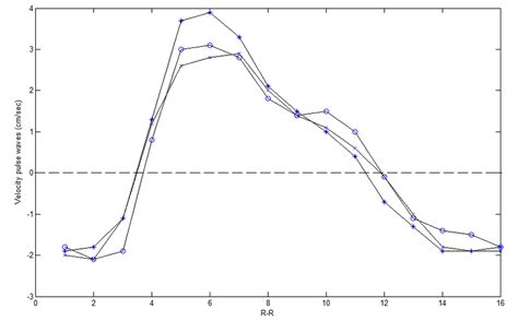Aqueductal CSF Flow Velocities Of Normal Subject In Three Times Over Download Scientific