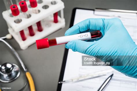 Botol Darah Dengan Sampel Darah Pada Bentuk Uji Foto Stok Unduh