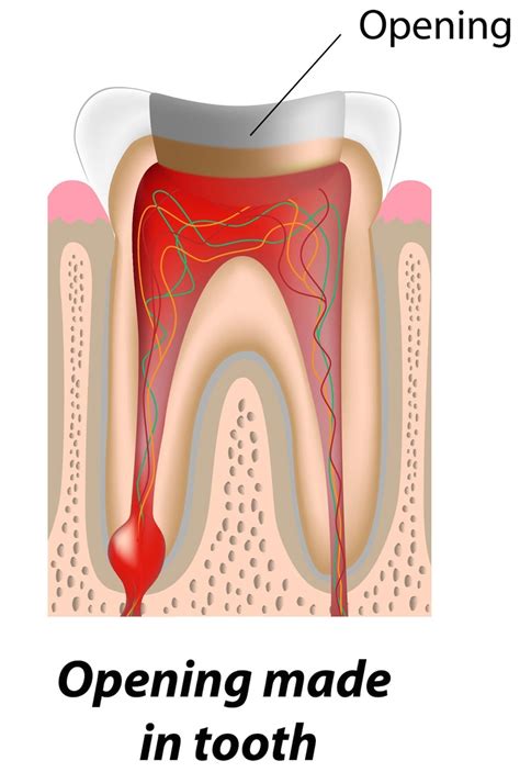 Gallery Southlake Endodontics