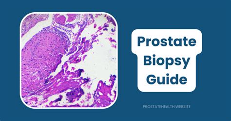 Prostate Biopsy Guide Procedure Risks Recovery Timeline
