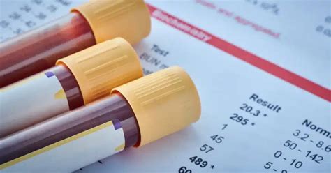 Erectile Dysfunction Test For Early Detection