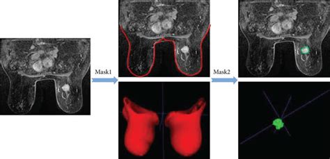 Example Of Coarse To Fine Segmentation Of The Deep Learning Download Scientific Diagram