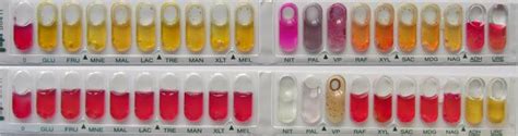 Regnum Prokaryotae Biochemical Tests