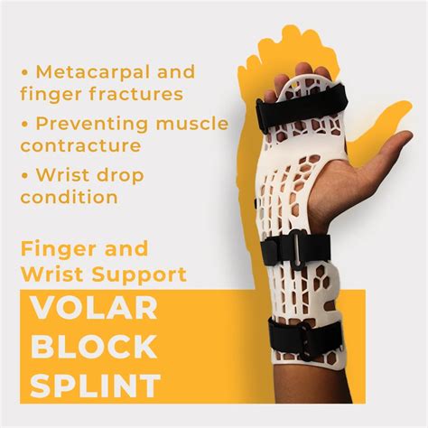 White Volar Block Hand Splint Model Name Number Ms Vb Size W At ₹ 3500 Piece In Bengaluru
