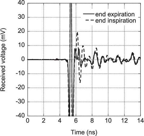 Figure 1 From Breath Activity Monitoring With Wearable Uwb Radars Measurement And Analysis Of