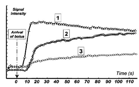 7 Example Of Dce Mri Time Intensity Curves In The Evaluation Of Bone