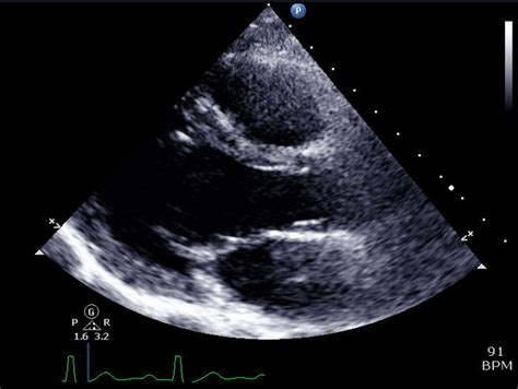 Making Sense Of An Echocardiogram Report For Gps — Cardiology Institute