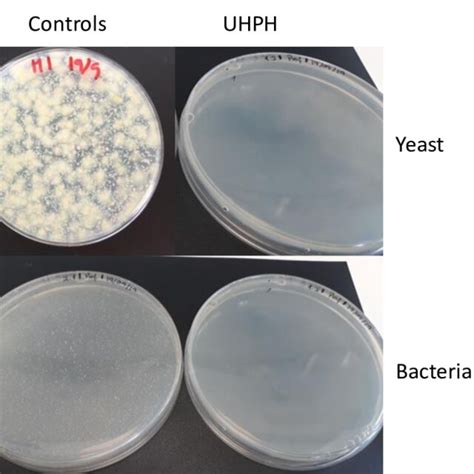 Microbial Counts Yeasts And Bacteria By Plating Before And After An