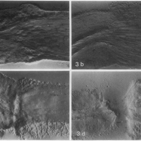 Serial Cross Sections In The Region Of The Abscission Layer And