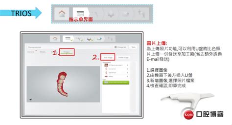 3shape口内扫描仪应用参数 安耐施义齿 魏广明的博客 Kq88口腔博客