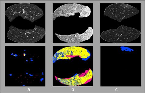 Failure Cases In The Segmentation Where Upper Row Contains Testing Download Scientific