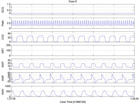 Case 6 Waveform Plots 60 Second Plots Case 6 Waveform Plots 60 Second Plots