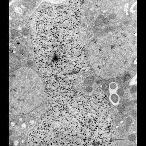 Micronucleus And Macronucleus