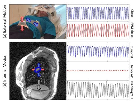 A External And B Internal Respiratory Motion Utilized To Program Download Scientific