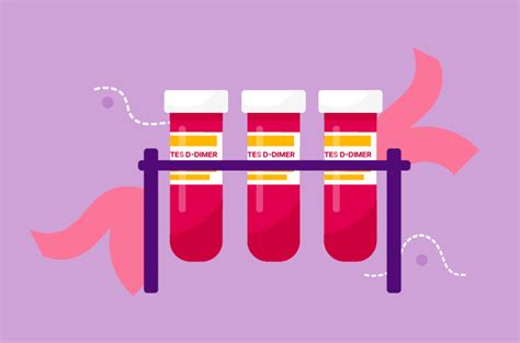 Tes D Dimer Tujuan Jenis Dan Prosedur Halodoc