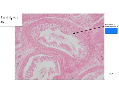 Epididymis 2 Histology Quiz