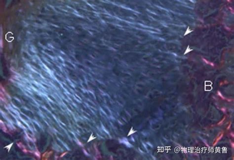 前交叉韧带组成结构 知乎