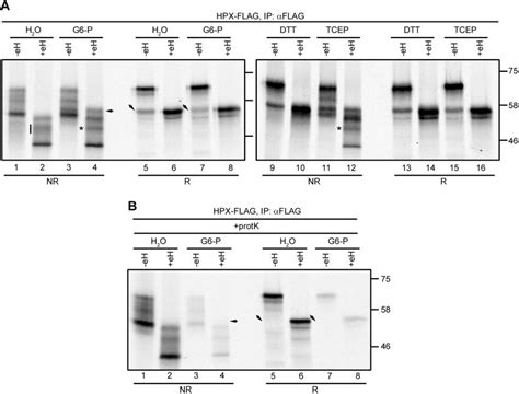 Hemopexin Forms Several Disulfide Bonded Species When Translated In The