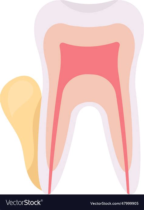 Flux Tooth Problem Royalty Free Vector Image Vectorstock