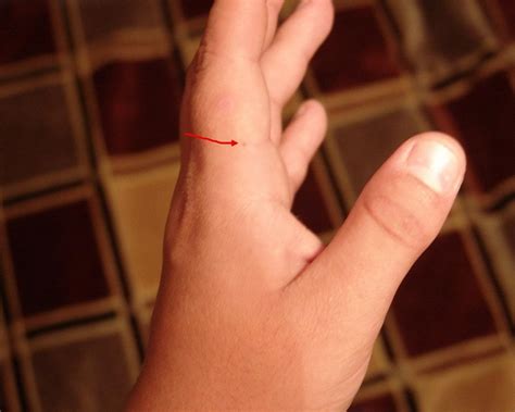 Что значит родинка на указательном пальце правой или левой руки ее влияние на судьбу