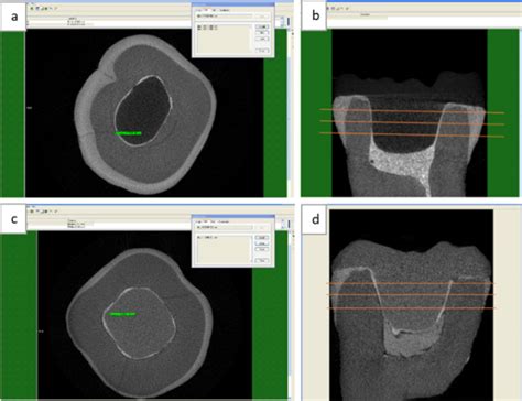 µct Scan Analyzer Measurements Of Cement Line Thickness A Download Scientific Diagram