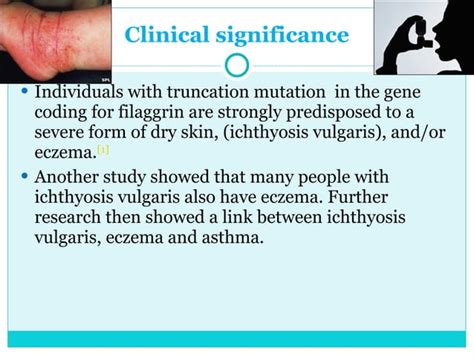 Sequence Alignment In Bioinformatics Ppt Skin And Dermatology Diseases And Conditions