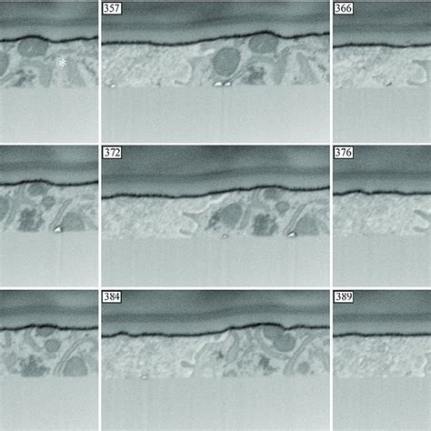 Fib Sem Tomography Serial Cross Section Fine Dendritic Processes Of