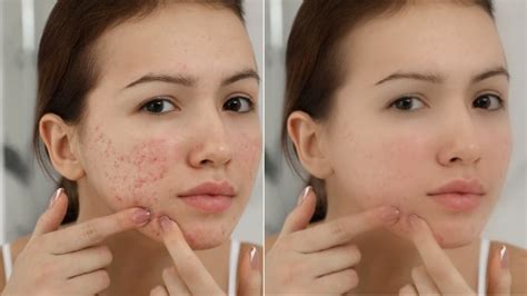 One Crystal That Can Remove All Dark Spots From Your Face Glowpink