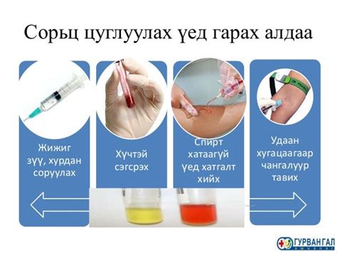 Сорьц цуглуулах үед гардаг түгээмэл алдаа