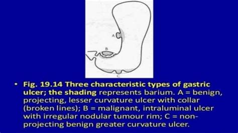 Stomach Radiologypptx