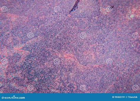 A Slide Of Lymph Tissue Reveals A Group Of Macrophages And Dendritic Cells Working In Tandem To