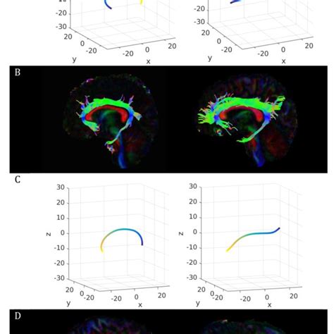 Shape Descriptors And Examples Of Segmented Tracts For Left Cingulum